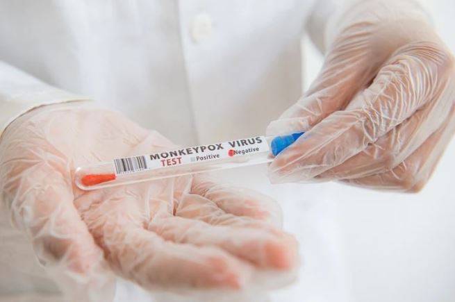 Прв случај на „Мајмунски сипаници“ регистриран во Шведска - telma.com.mk